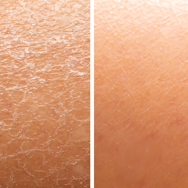 Hydrolatum BAR – Mazton Skin Solutions