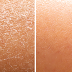 Hydrolatum BAR – Mazton Skin Solutions