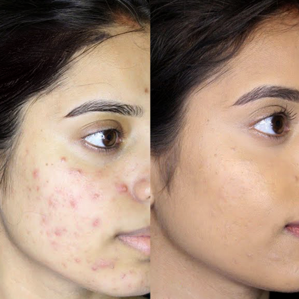 Mazton Skin Solutions