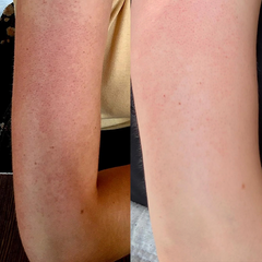 Metafil Moisturising Lotion – Mazton Skin Solutions