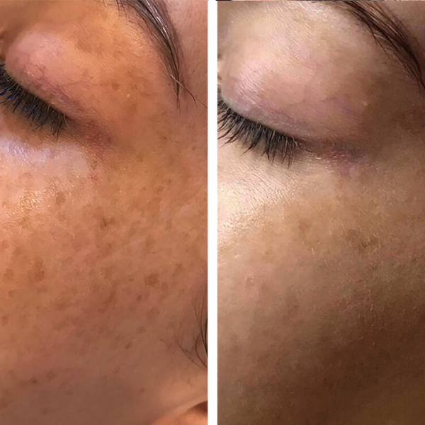 SunPRO 80 Cream – Mazton Skin Solutions